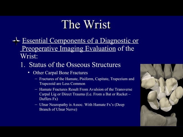 Wrist MRI Magnetic Resonance Imaging.ppt