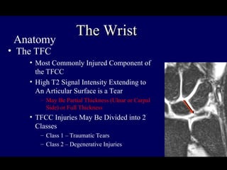 Wrist MRI Magnetic Resonance Imaging.ppt