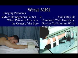 Wrist MRI Magnetic Resonance Imaging.ppt
