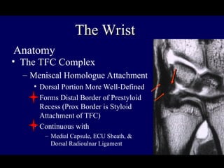 Wrist MRI Magnetic Resonance Imaging.ppt