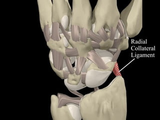 Wrist MRI Magnetic Resonance Imaging.ppt