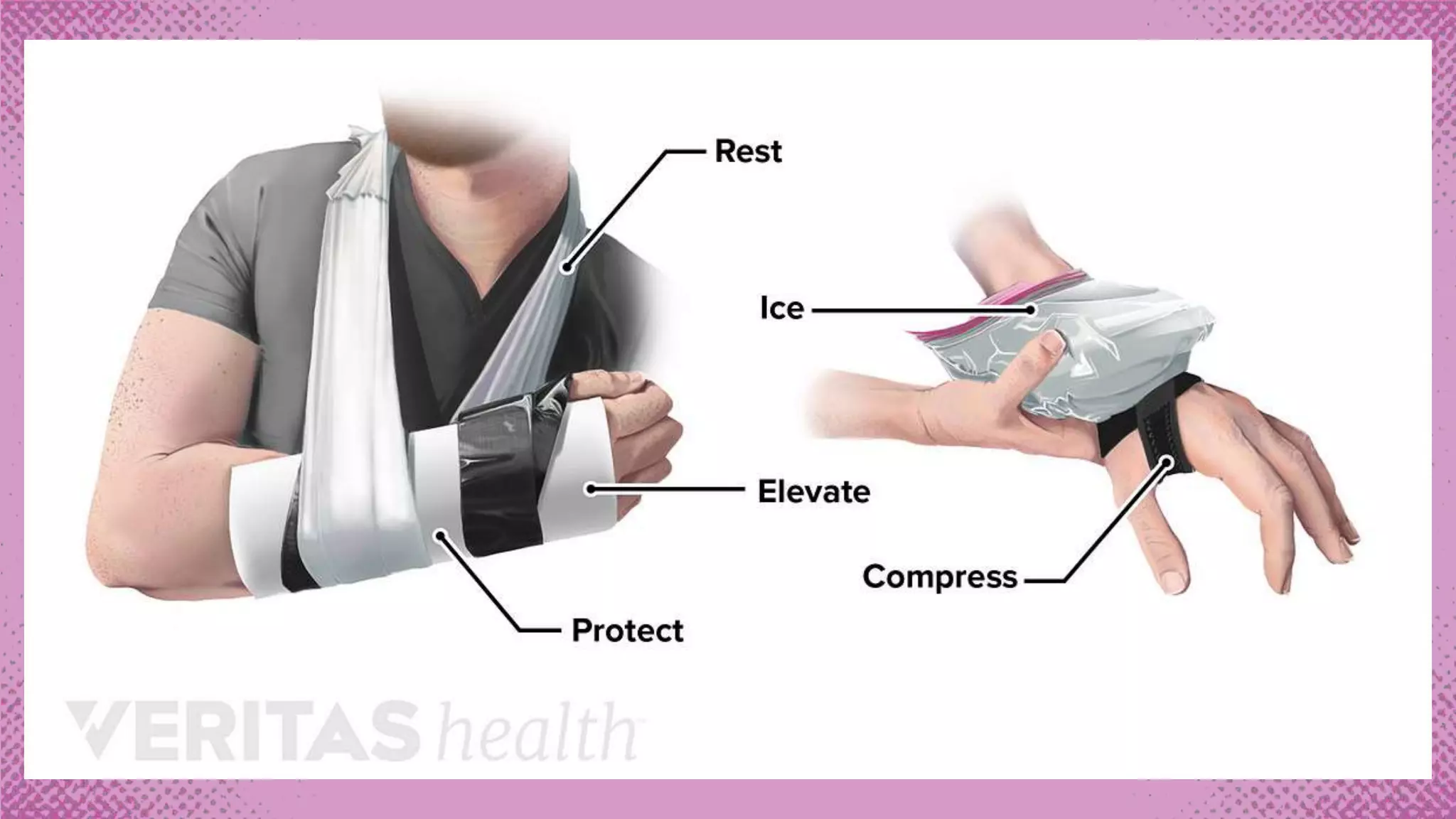 Wrist Muscles | PPTX