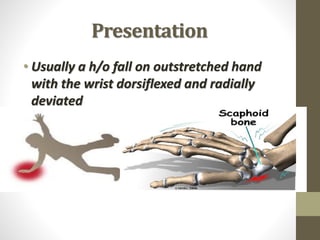 Wrist pain | PPTX