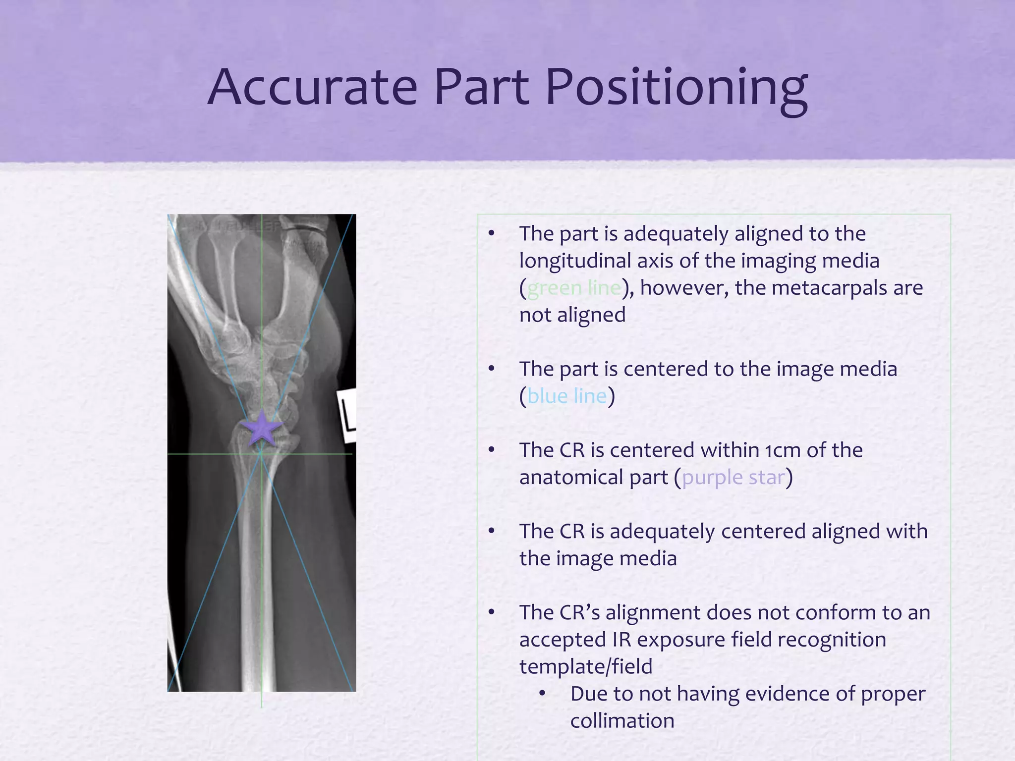 Wrist presentation | PPTX