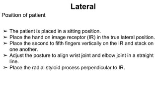 WRIST RADIOGRAPHY , Bathmahariswaran (1).pptx