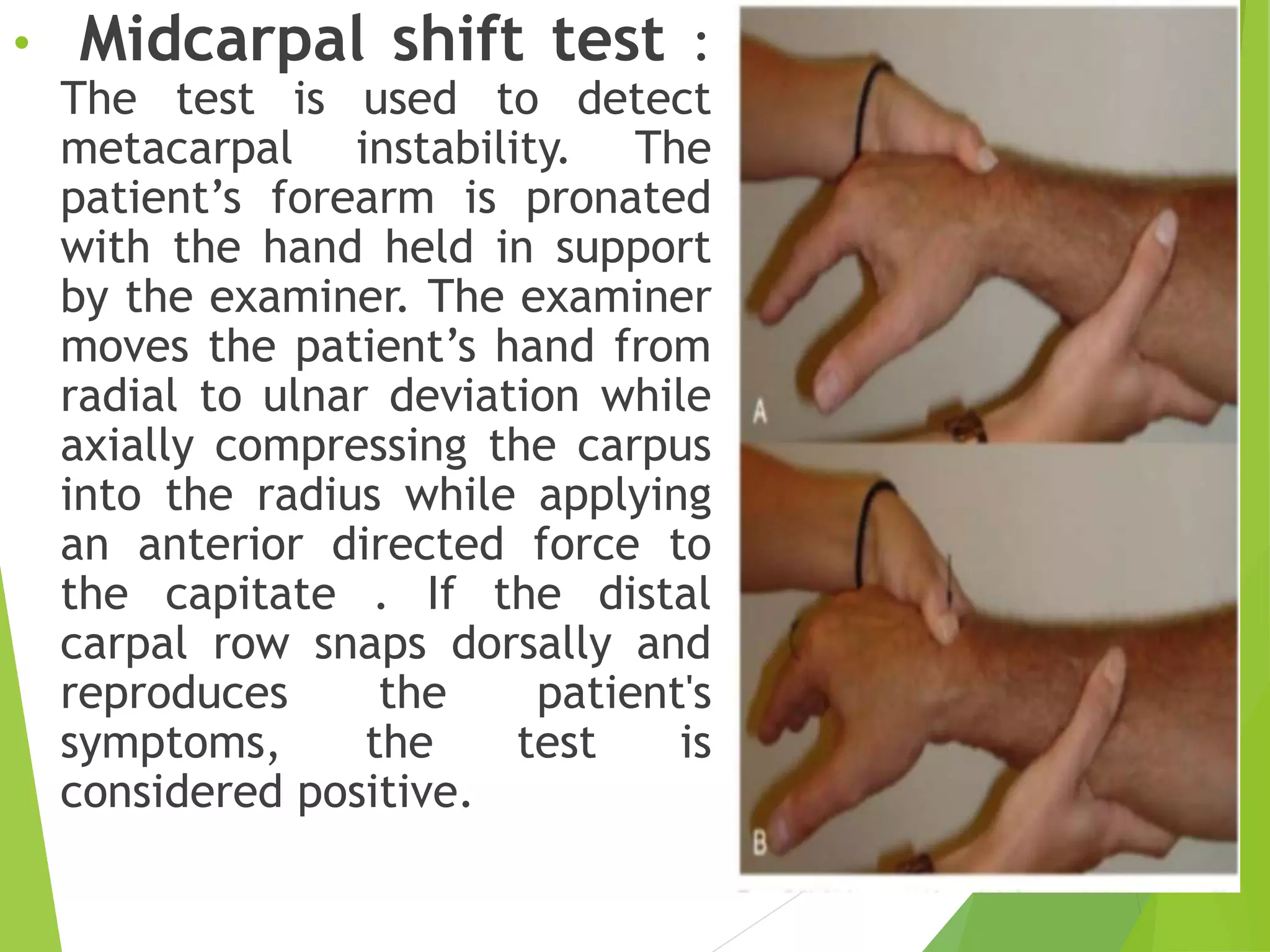wrist sprain.pptx