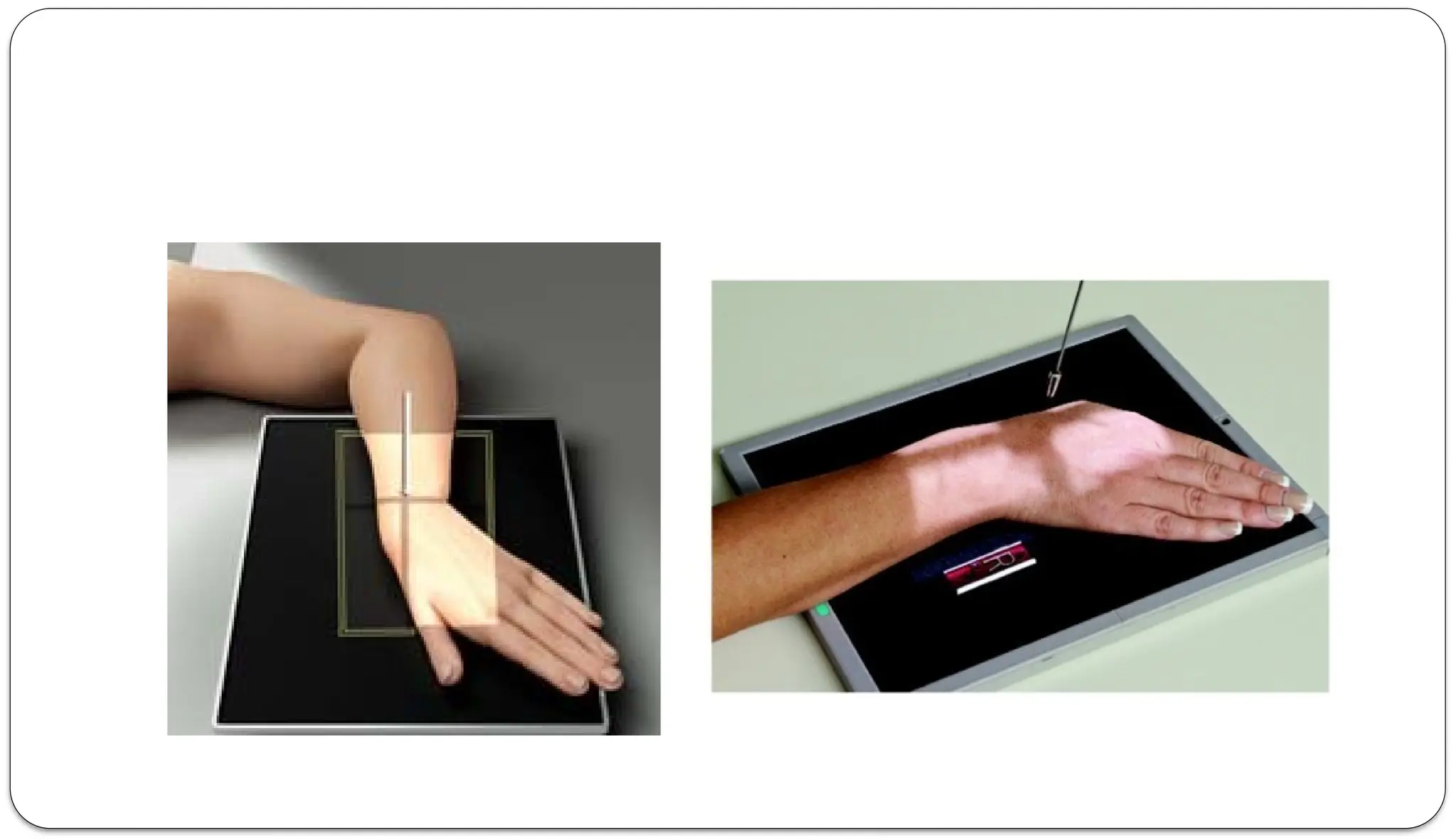 WRIST X RAY SERIES human limbs and bones study | PPT