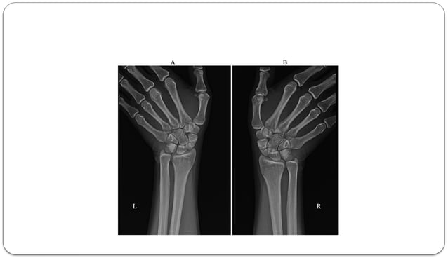 WRIST X RAY SERIES human limbs and bones study | PPT