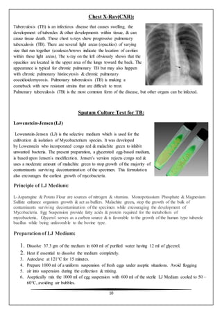 Detailed examination of tuberculosis in microbiology laboratory ...