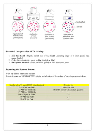 Detailed examination of tuberculosis in microbiology laboratory ...
