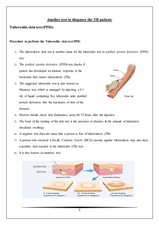 Detailed examination of tuberculosis in microbiology laboratory ...