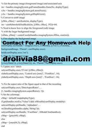 write a MATLAB GUI program that implements an ultrasound image viewi.pdf