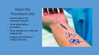 Wrong Sided Surgery | PPTX