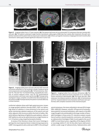 The noms framework_approach_to_the_treatment_of_spinal_metastatic ...