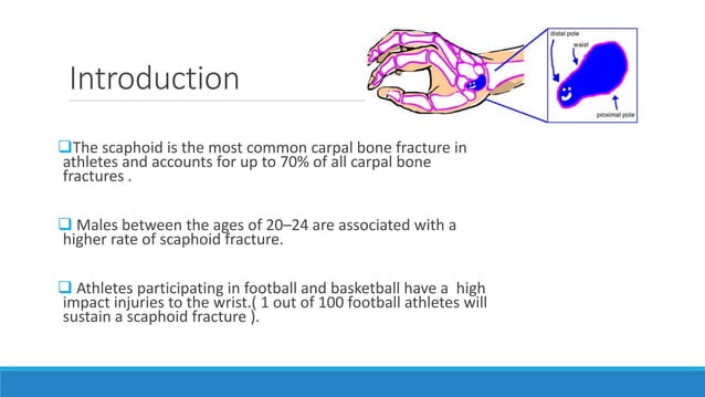 Wrist joint overuse and sport injuries | PPT
