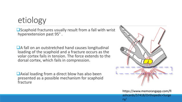 Wrist joint overuse and sport injuries | PPT