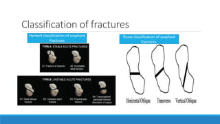 Wrist joint overuse and sport injuries | PDF