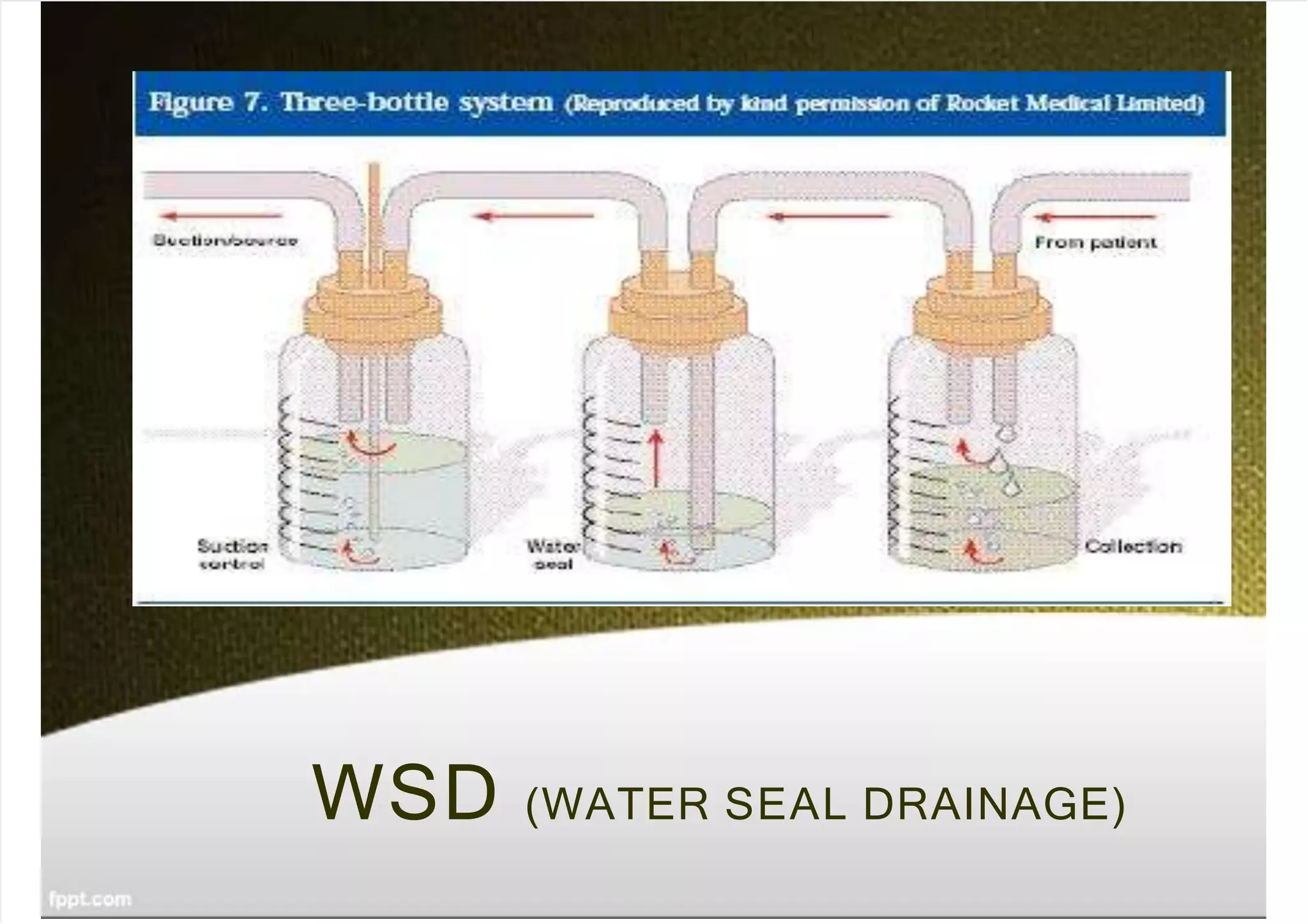 Tatalaksana WSD.pptx