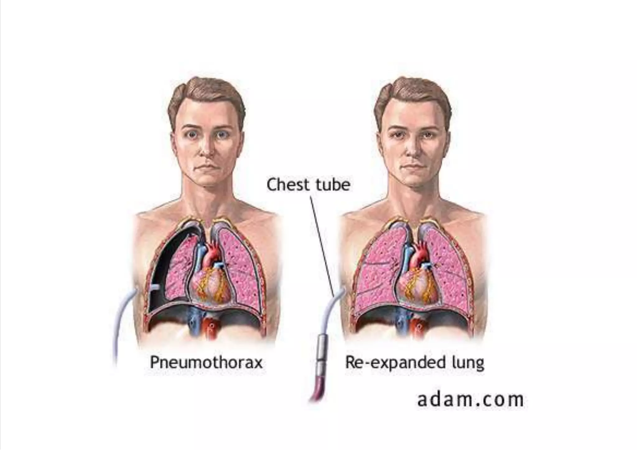 Tatalaksana WSD.pptx