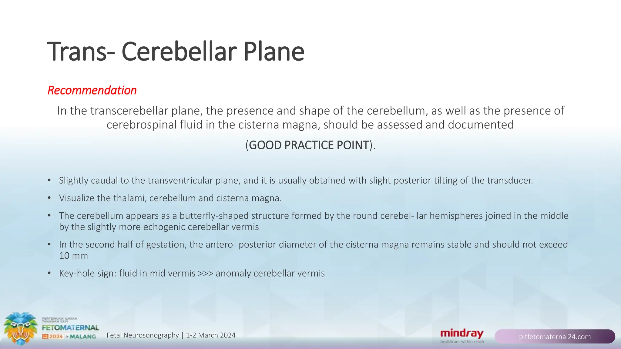 WSFN1 - PPT New ISUOG Guidelines for CNS Evaluation 1 TM & 2_3 TM, and ...