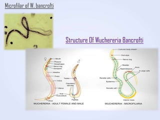 Wuchereria and Trichinella ZOOLOGY.pdf