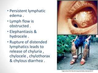 Wuchereria bancrofti | PPT