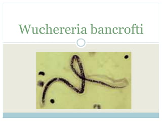 Nematoda Wuchereria