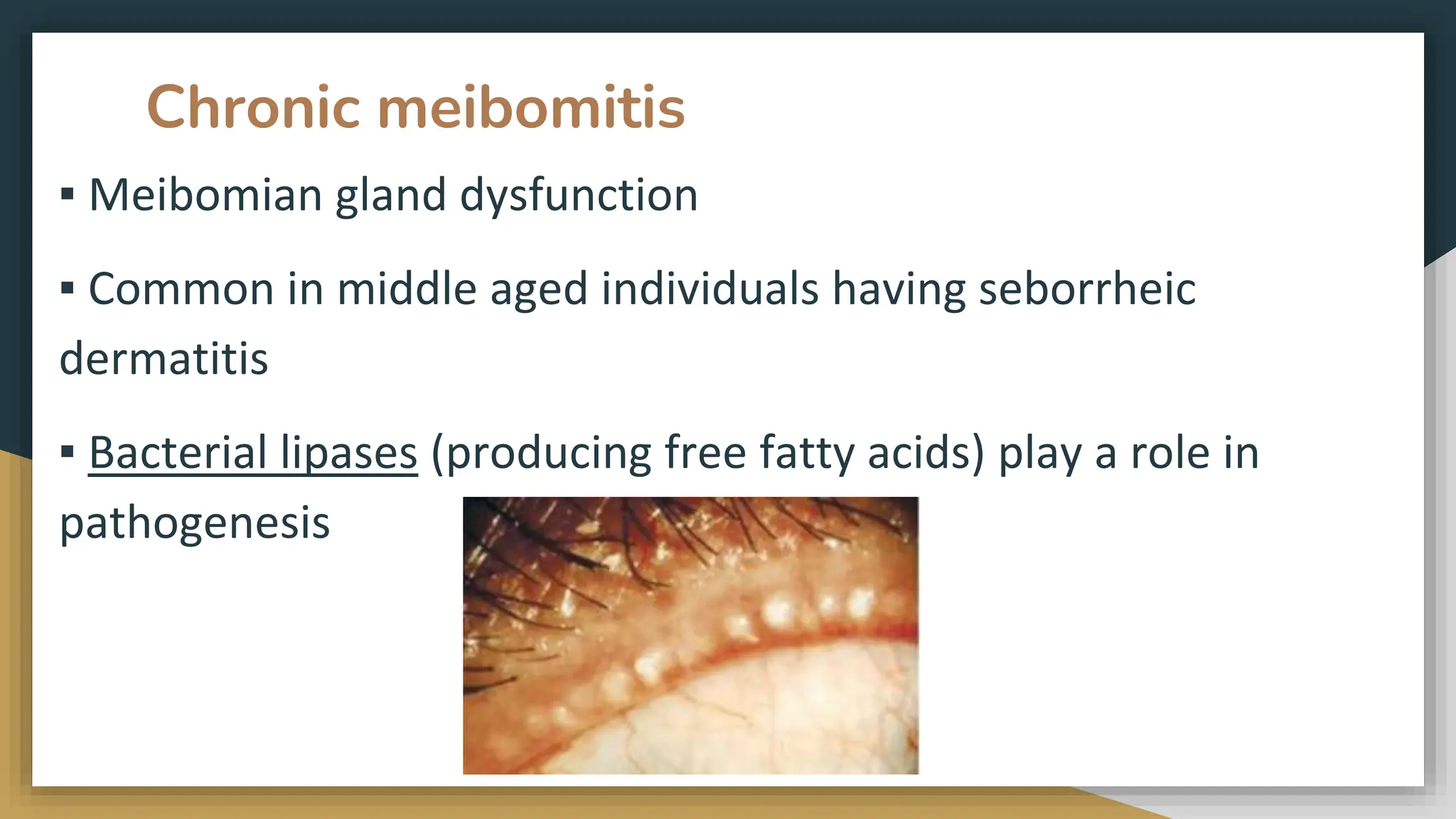 BLEPHARITIS - introduction, types, Etiology, pathogenesis, clinical ...