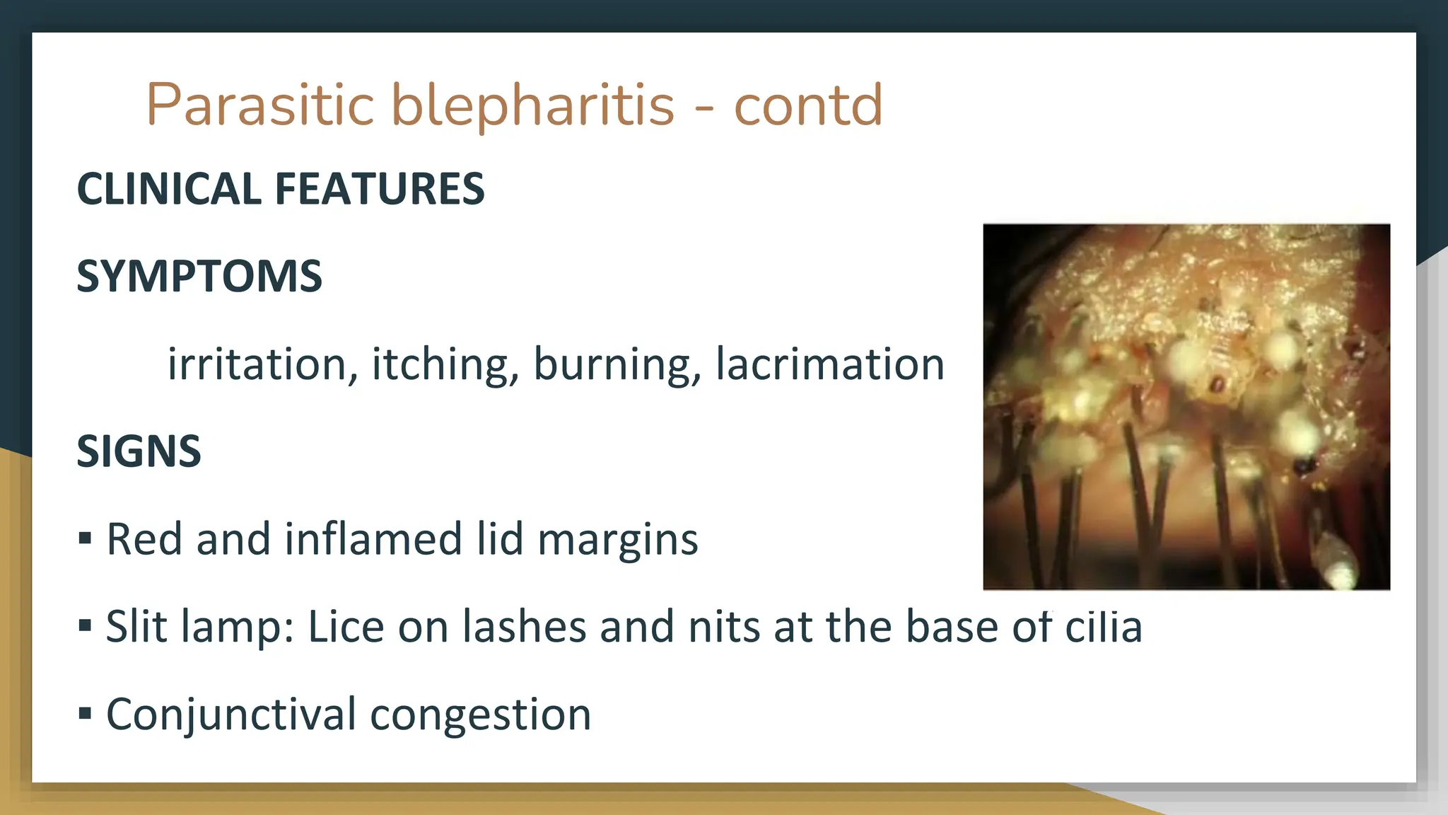 BLEPHARITIS - introduction, types, Etiology, pathogenesis, clinical ...