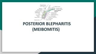 BLEPHARITIS - introduction, types, Etiology, pathogenesis, clinical ...