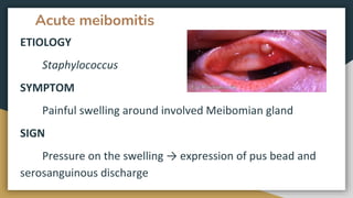 BLEPHARITIS - introduction, types, Etiology, pathogenesis, clinical ...