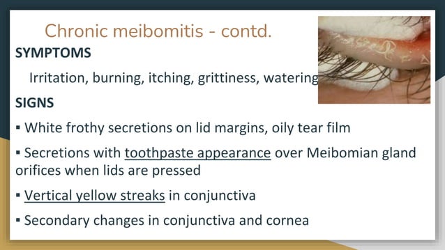 BLEPHARITIS - introduction, types, Etiology, pathogenesis, clinical ...
