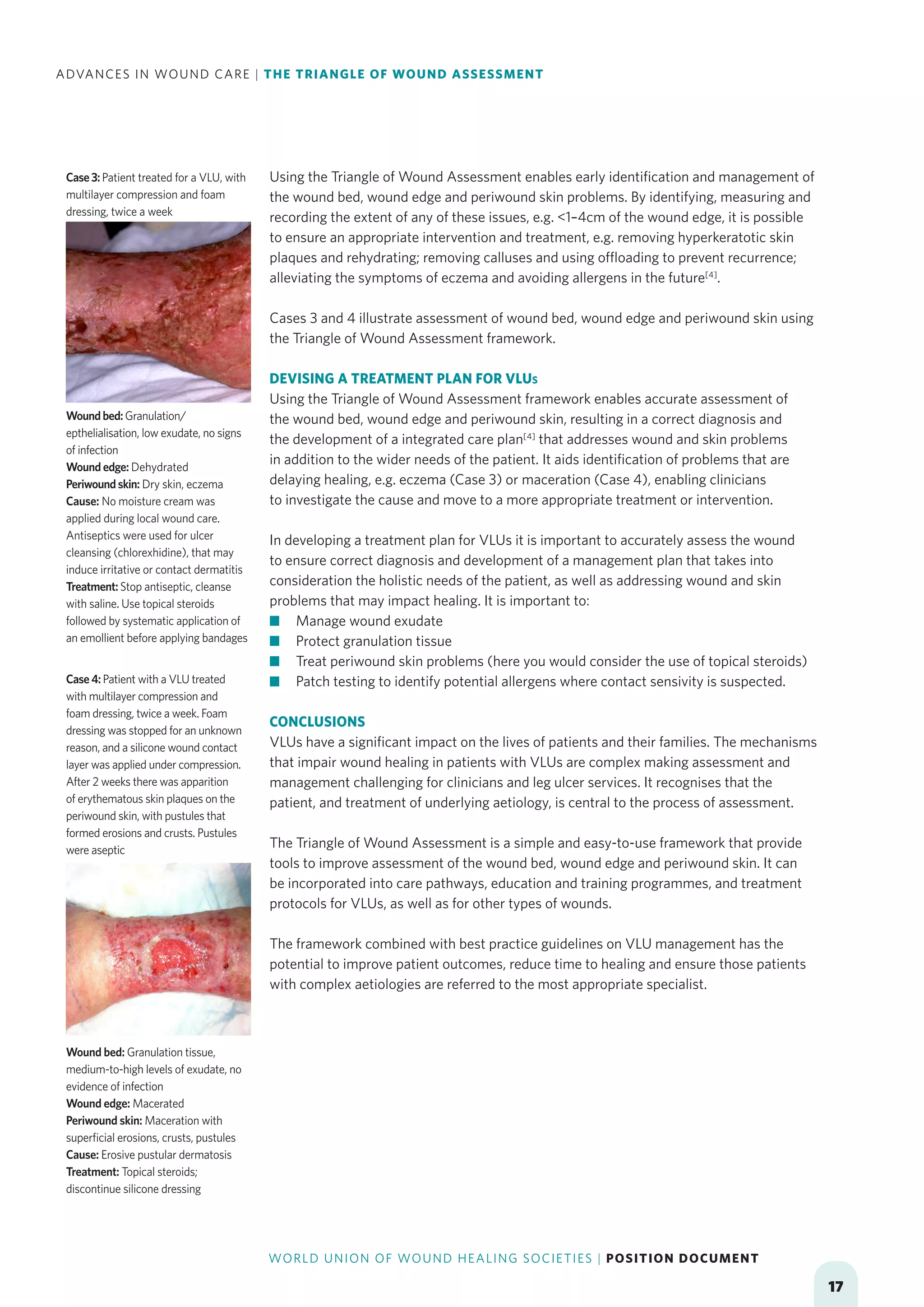 ADVANCES IN WOUND CARE: THE TRIANGLE OF WOUND ASSESSMENT | PDF