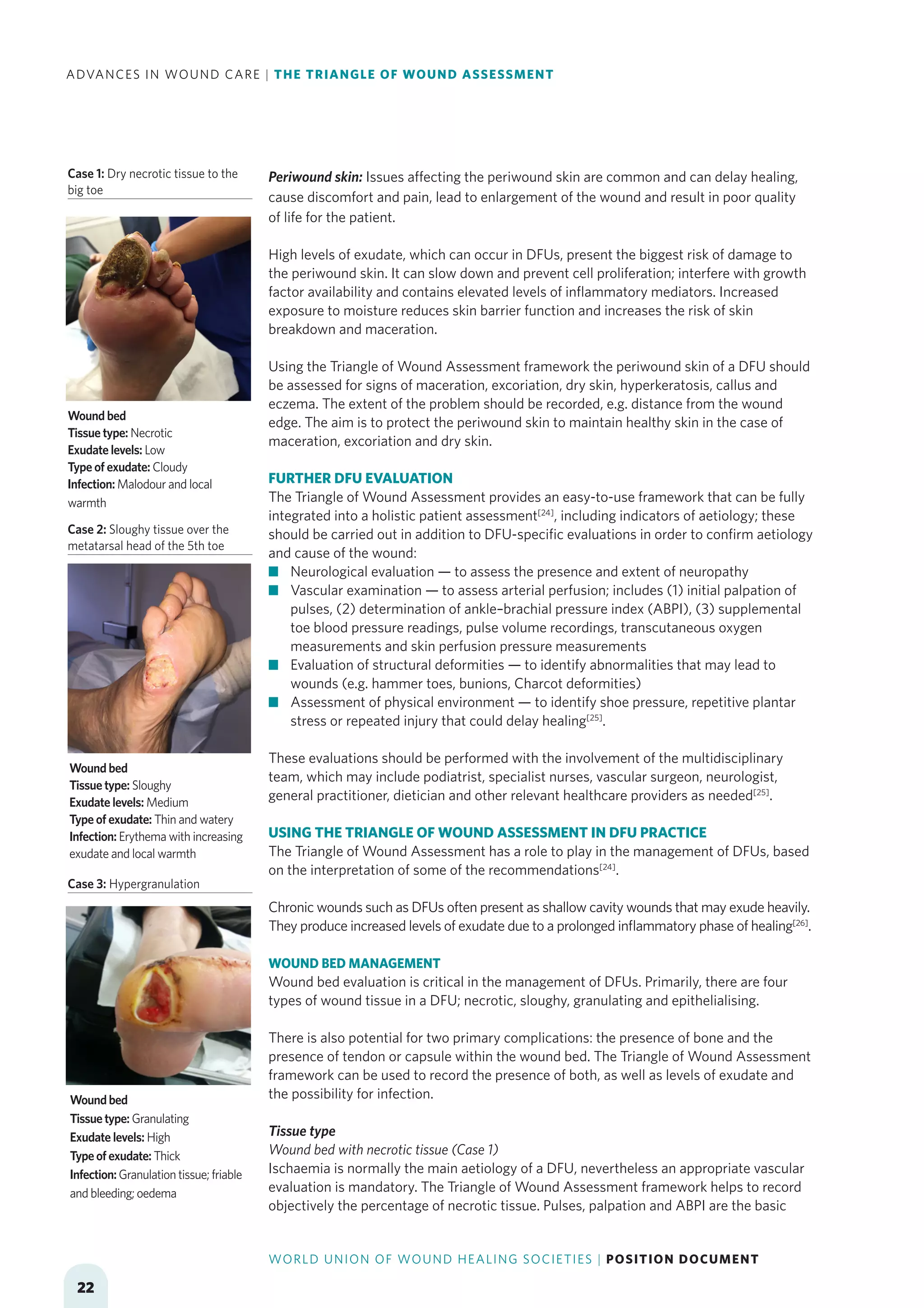 ADVANCES IN WOUND CARE: THE TRIANGLE OF WOUND ASSESSMENT | PDF