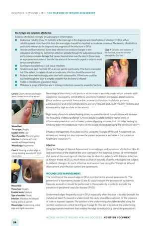 ADVANCES IN WOUND CARE: THE TRIANGLE OF WOUND ASSESSMENT | PDF