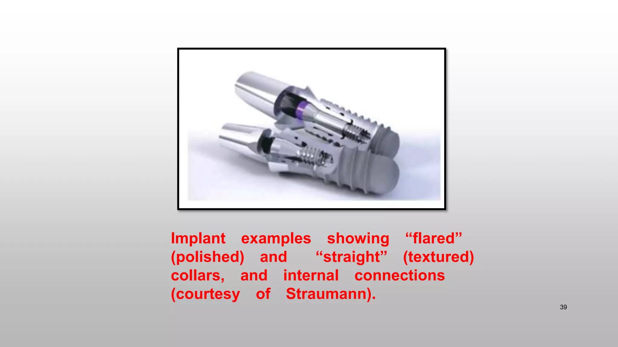 3 implant systems | PPTX