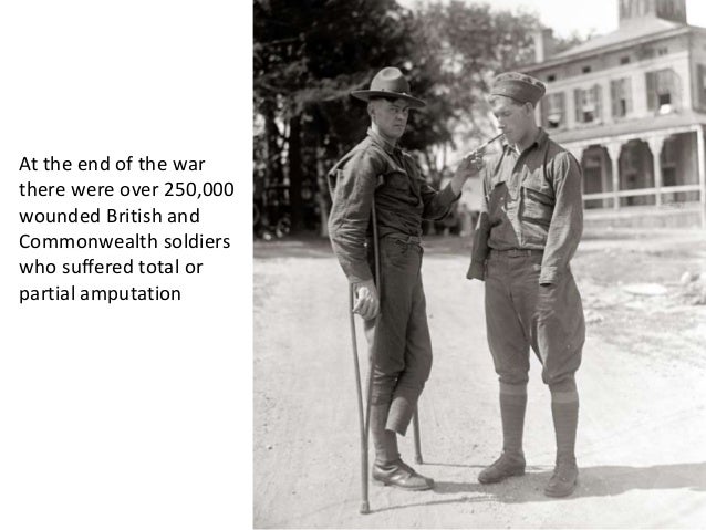 25 Ww1 Facts And Figures That Show The Reality Of The