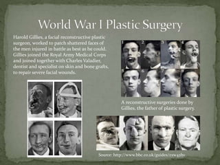 Wwi impact | PPTX