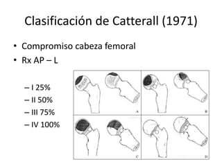 Clasificaciones en Enfermedad de Perthes | PPTX