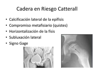 Clasificaciones en Enfermedad de Perthes | PPTX