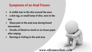Anal fissure Treatment In Chennai | Fissure Surgery In India | PDF ...