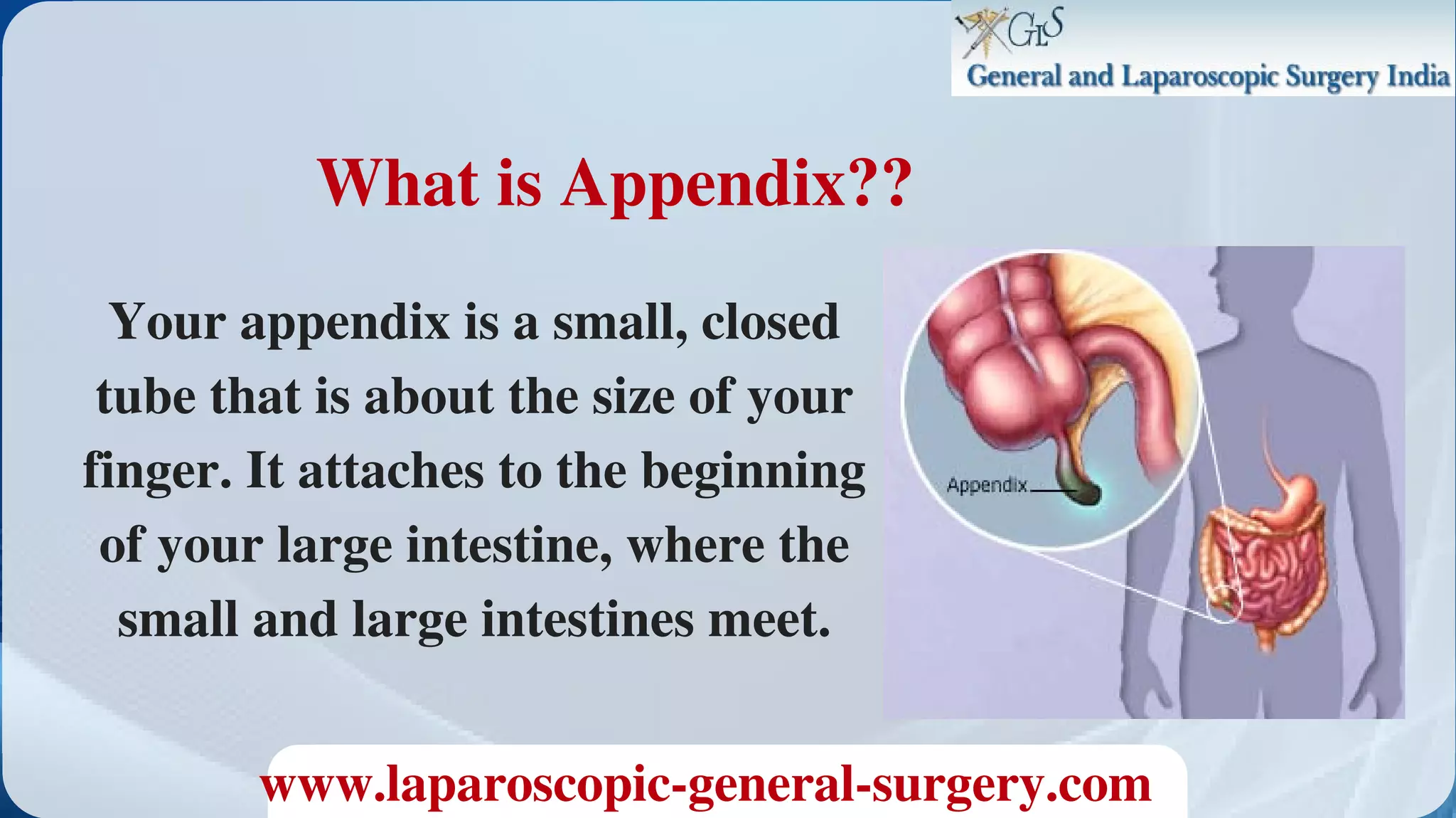 Appendix Removal Surgery In Bangalore | Laparoscopic Appendicitis ...