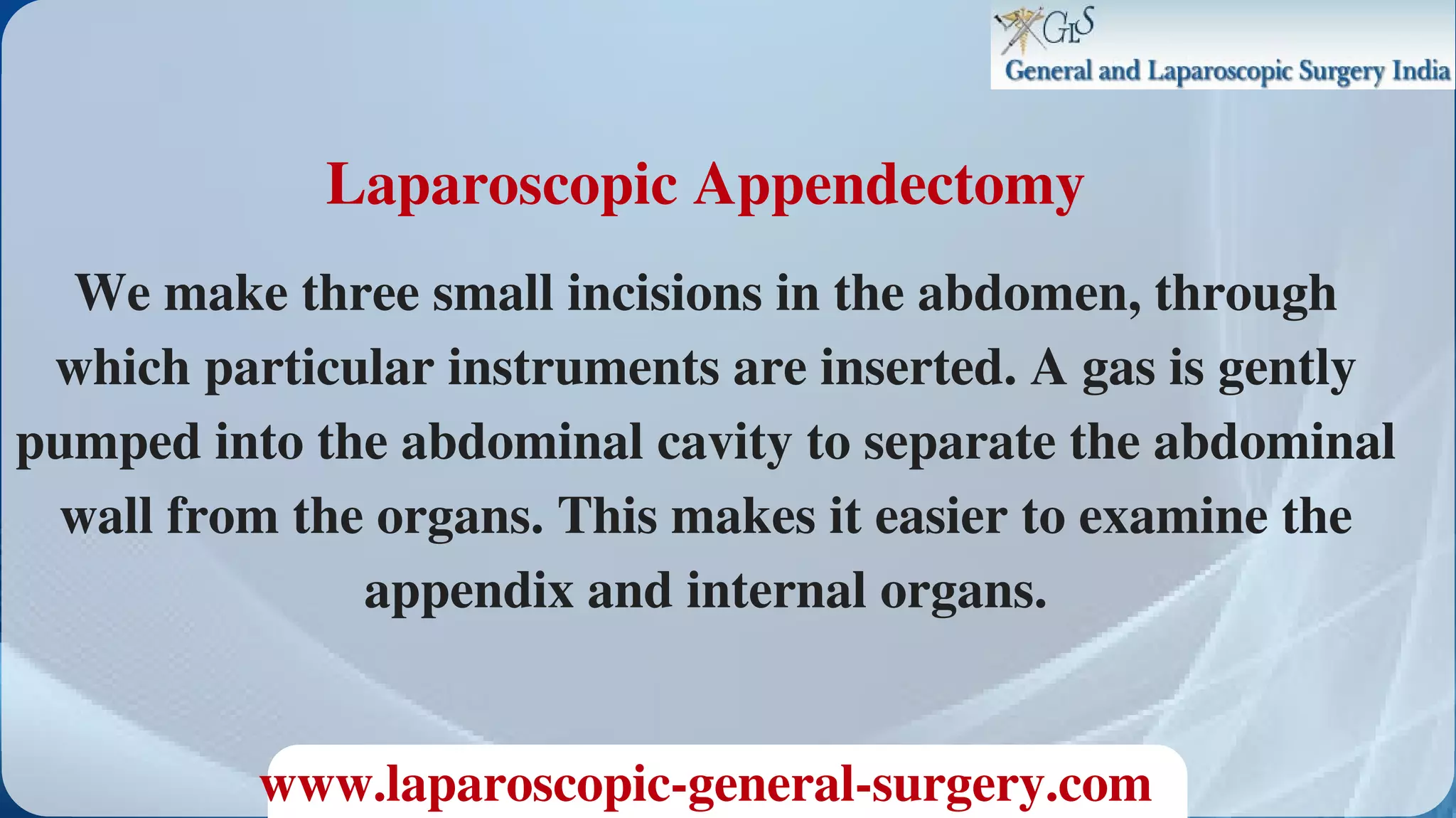 Appendix Removal Surgery In Bangalore | Laparoscopic Appendicitis ...