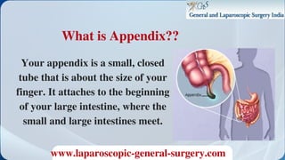 Appendix Removal Surgery In Bangalore | Laparoscopic Appendicitis ...