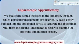 Appendix Removal Surgery In Bangalore | Laparoscopic Appendicitis ...