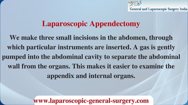 Appendix Removal Surgery In Bangalore | Laparoscopic Appendicitis ...