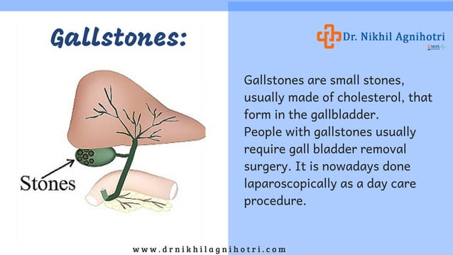 Gall Stone Treatment in Mumbai | Laparoscopic Cholecystectomy in India ...