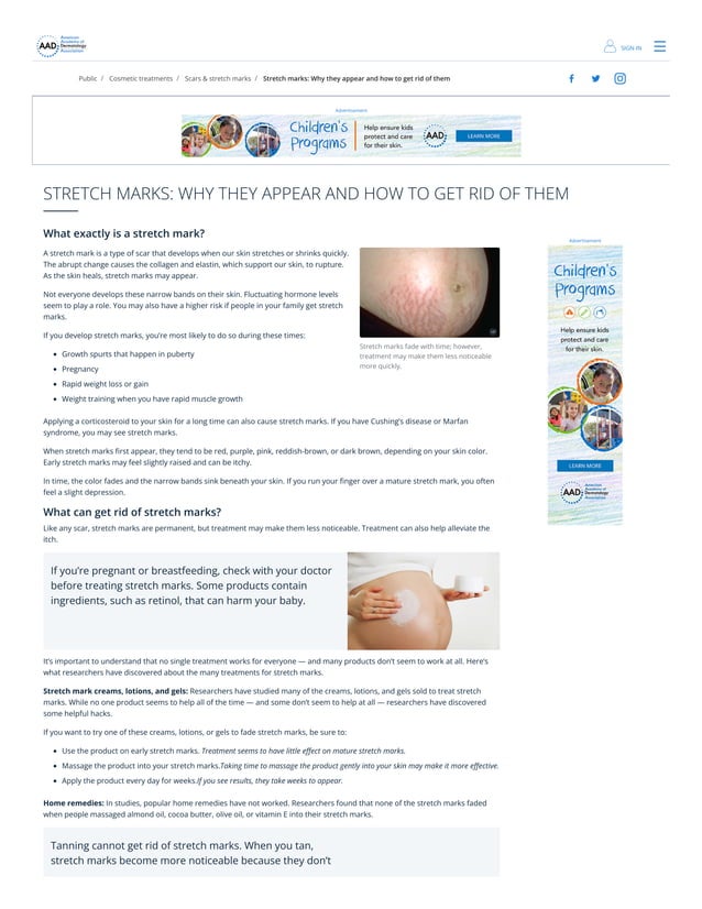 STRETCH MARKS: WHY THEY APPEAR AND HOW TO GET RID OF THEM | PDF