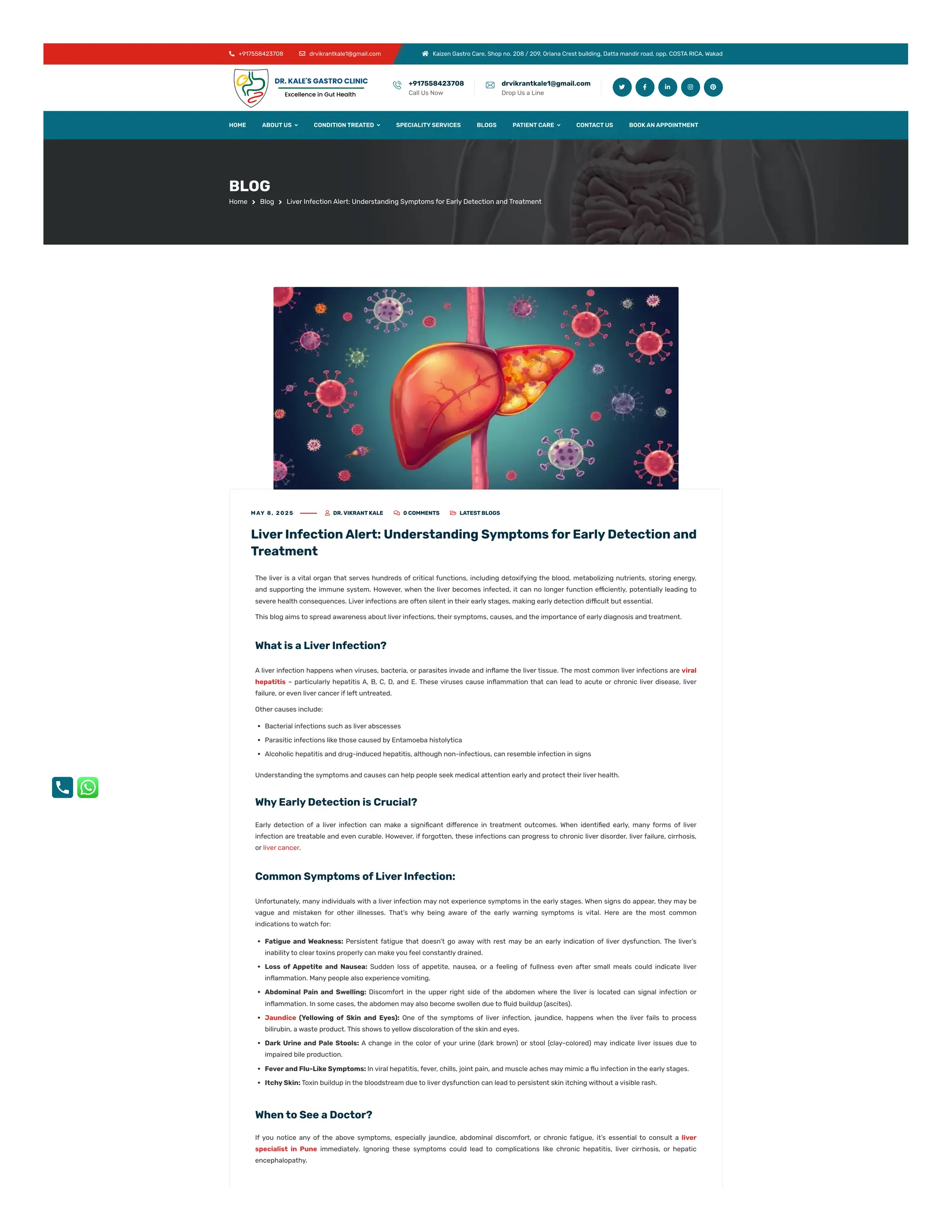 liver-infection-alert-understanding-symptoms-for-early-detection-and ...
