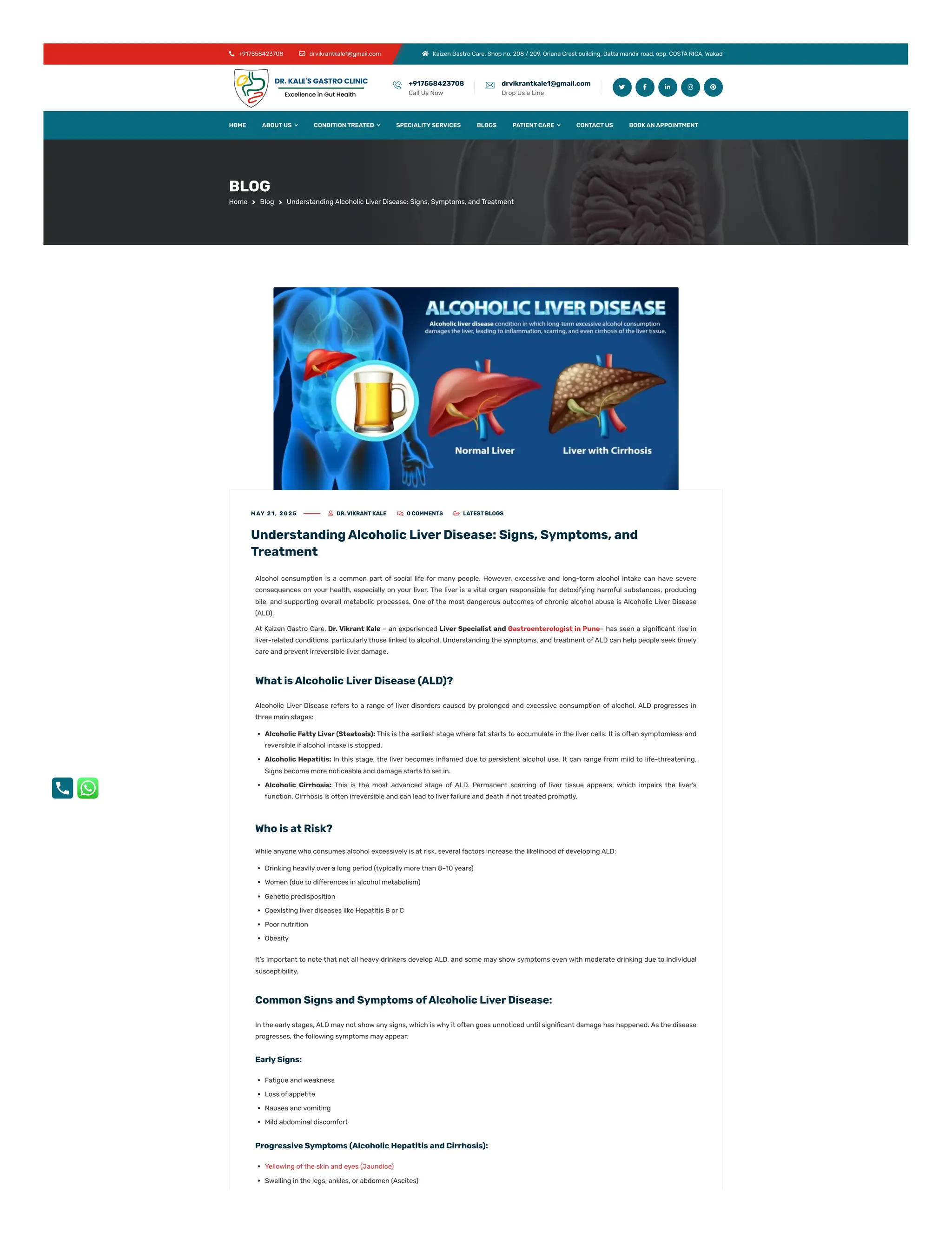 Understanding Alcoholic Liver Disease: Signs, Symptoms, and Treatment | PDF